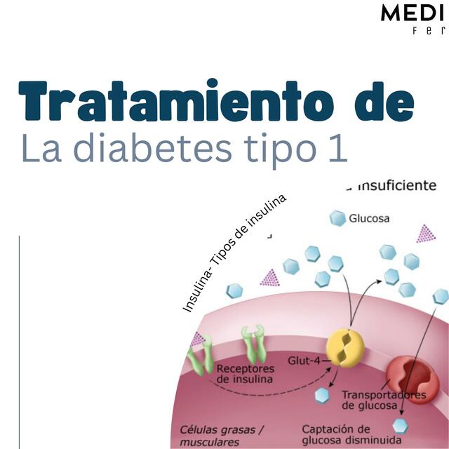 Tratamiento de DM1 | medi_fer | uDocz
