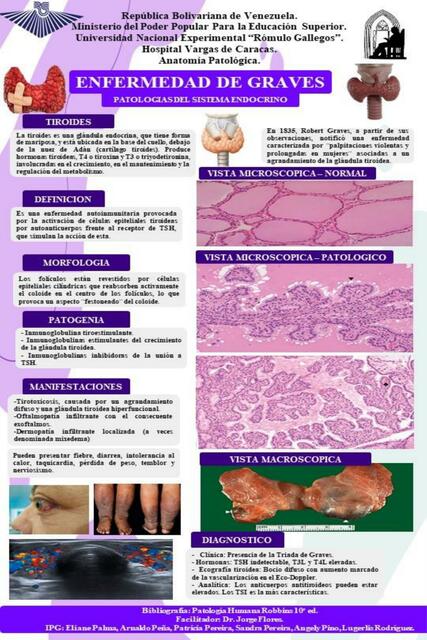 Enfermedad de graves | david | uDocz