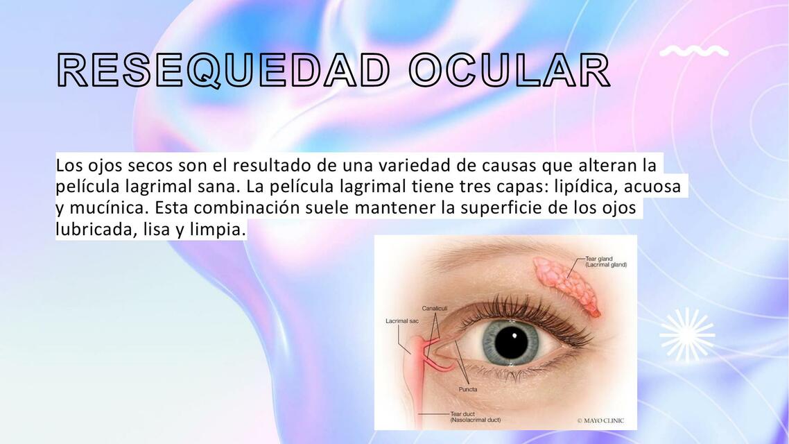 Resequedad ocular y glaucoma | Alexandra | uDocz