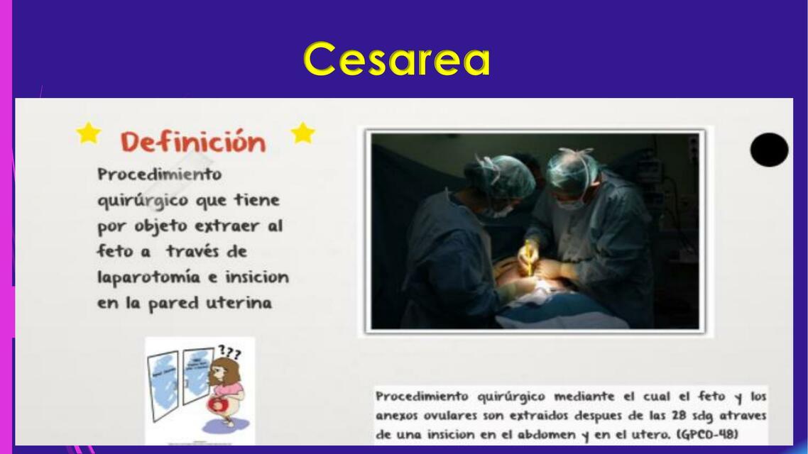 cesarea | Ruben | uDocz