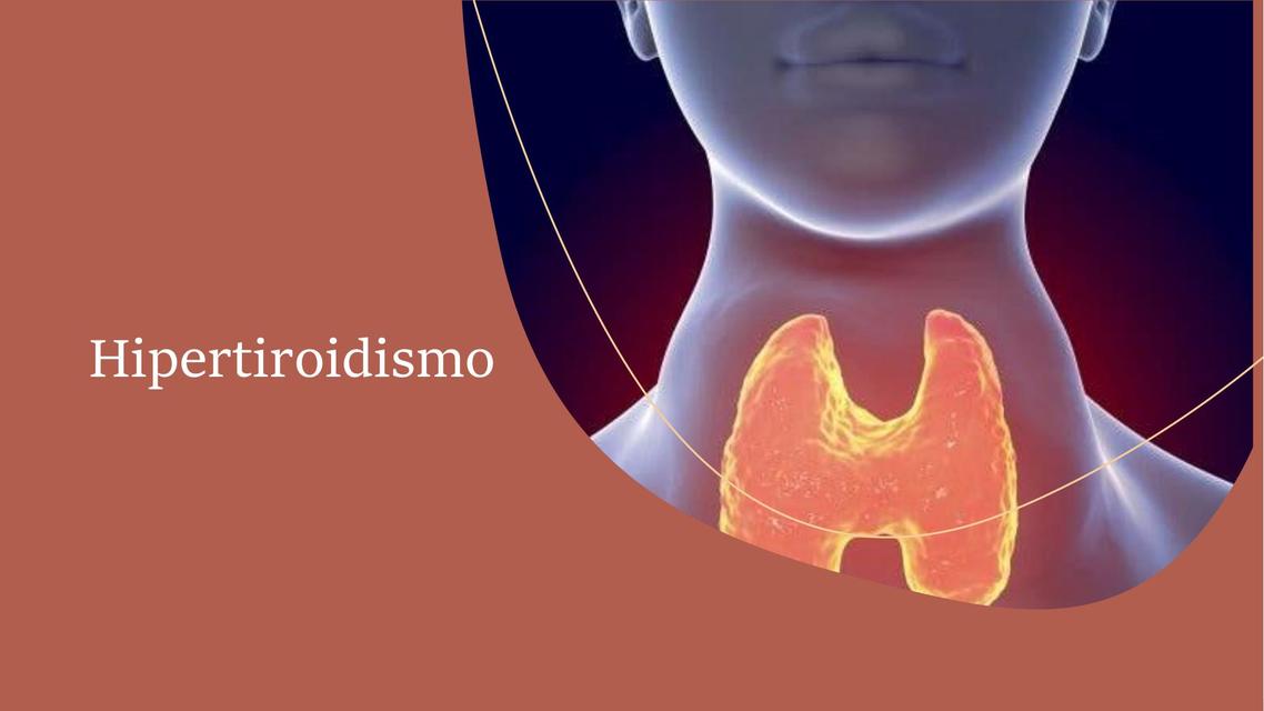 Resúmenes de Hipertiroidismo | Descarga apuntes de Hipertiroidismo