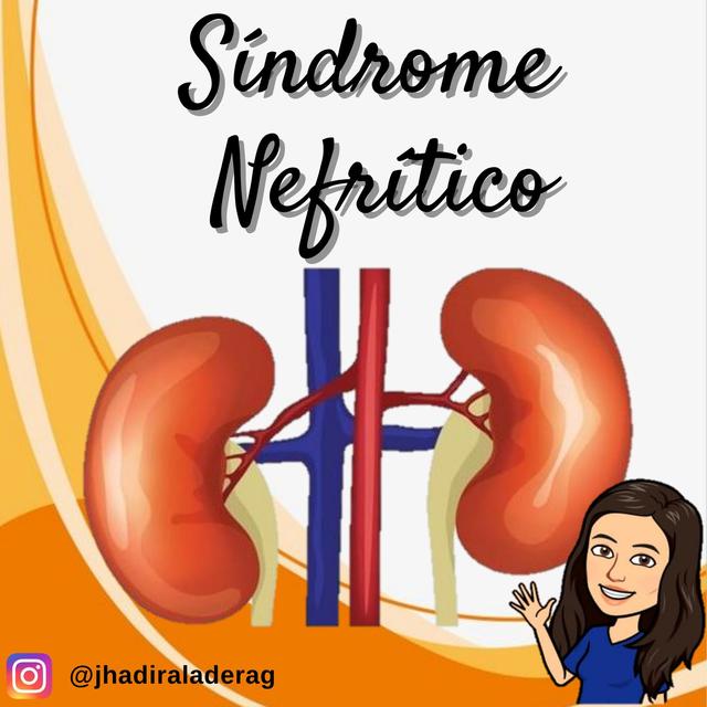 Síndrome Nefrítico | Síndrome nefrítico | Medicina humana | uDocz