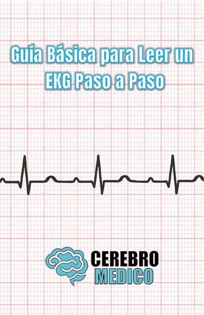Guia Basica para Leer un EKG Paso a Paso CerebroMedico | Cerebro Medico | uDocz