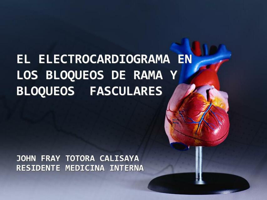 Flashcards de BLOQUEO DE RAMAS | Por John Fray Totora Calisaya | uDocz