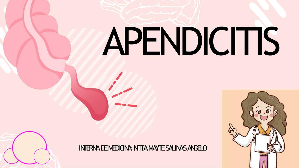 Apendicitis | in | uDocz