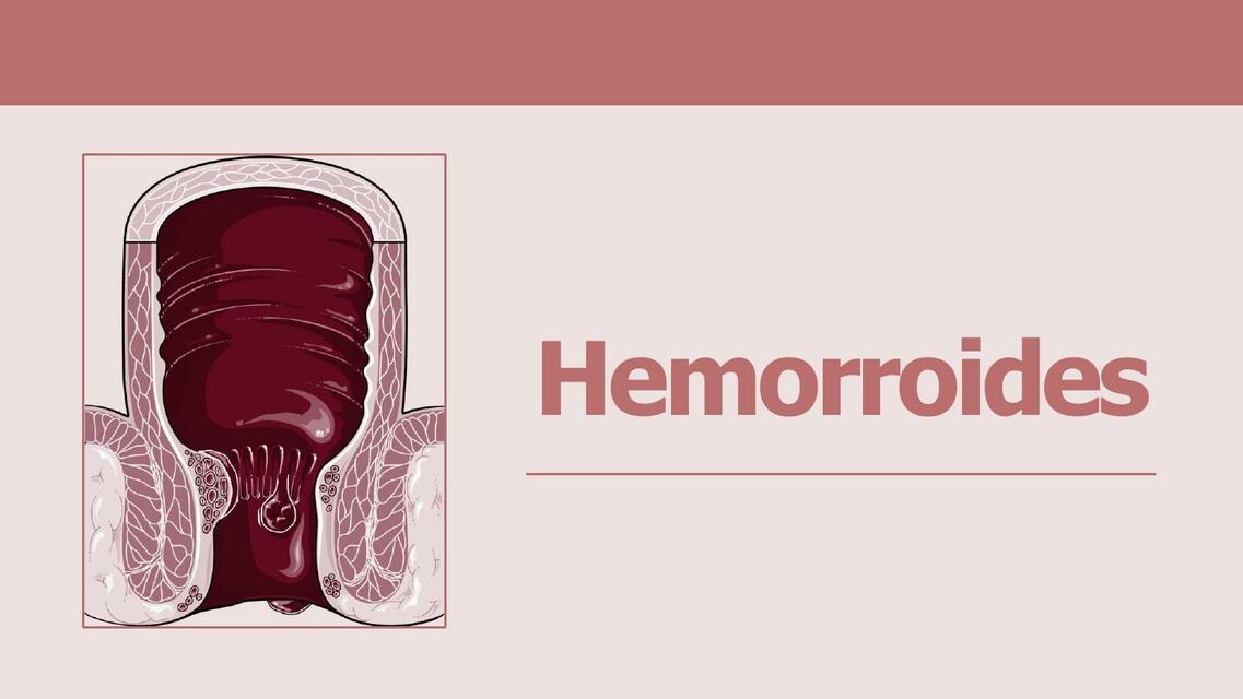 Hemorroides Teoria y caso | Lupita | uDocz