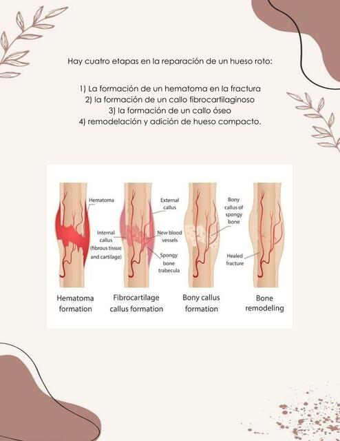 Etapas en la reparación de un hueso roto | fraii | uDocz