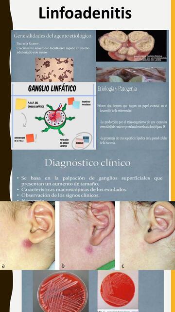 Infografía linfoadenitis | bioanatomia | uDocz