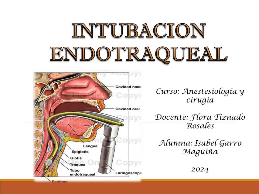 INTUBACIÓN ENDOTRAQUEAL | Isabel | uDocz