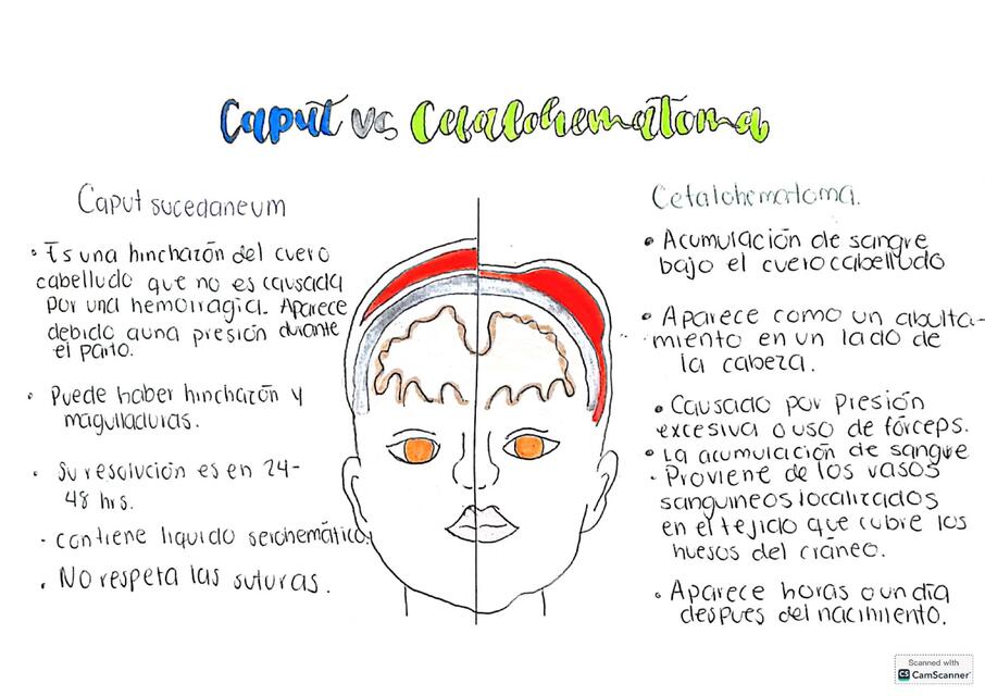 Caput vs Cefalohematoma | Illescas Martínez Paola Lucrecia | uDocz