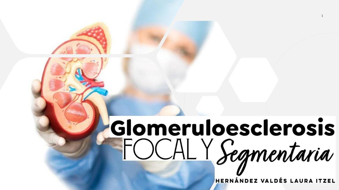 Glomerulonefritis Focal y Segmentaria LIHV | @DraHrndz | uDocz