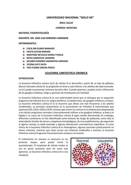 LEUCEMIA linfocitica cronica | Daleny Martinez Revollo | uDocz LEUCEMIA linfocitica cronica | Daleny Martinez Revollo | uDocz