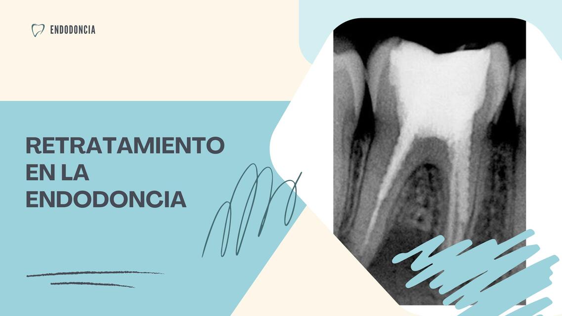 RETRATAMIENTO EN LA ENDODONCIA | Leydi Melissa | uDocz
