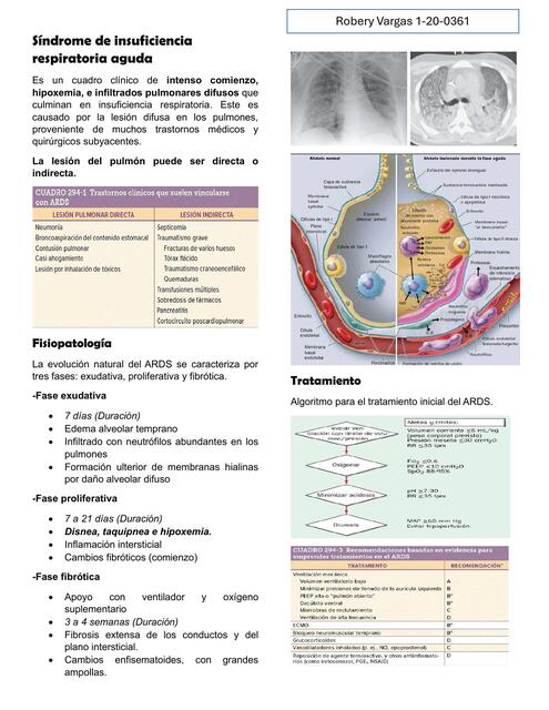 Resúmenes de síndrome de insuficiencia respiratoria aguda | Descarga ...