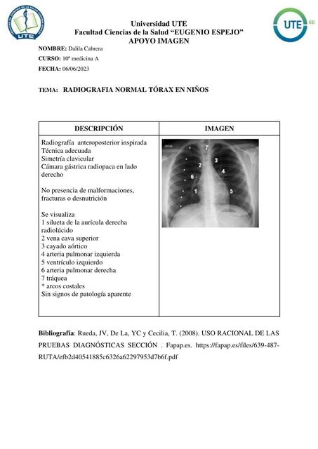 APOYO IMAGEN RX NORMAL TORAX | Silvia Cabrera | uDocz