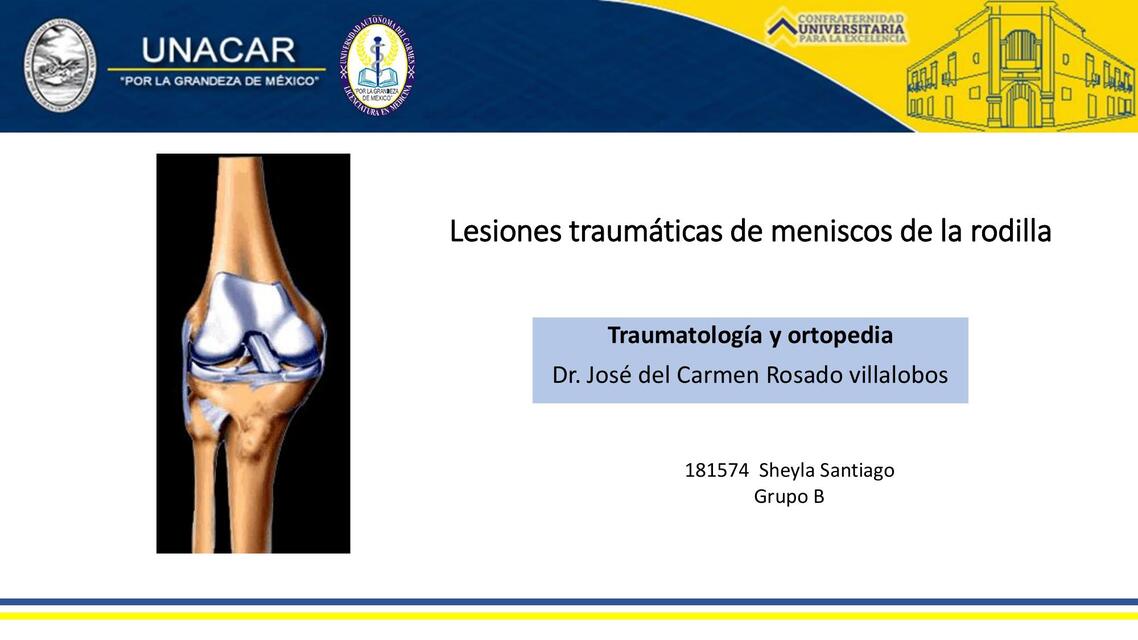 Lesiones traumáticas de meniscos de la rodilla | Panquesito | uDocz