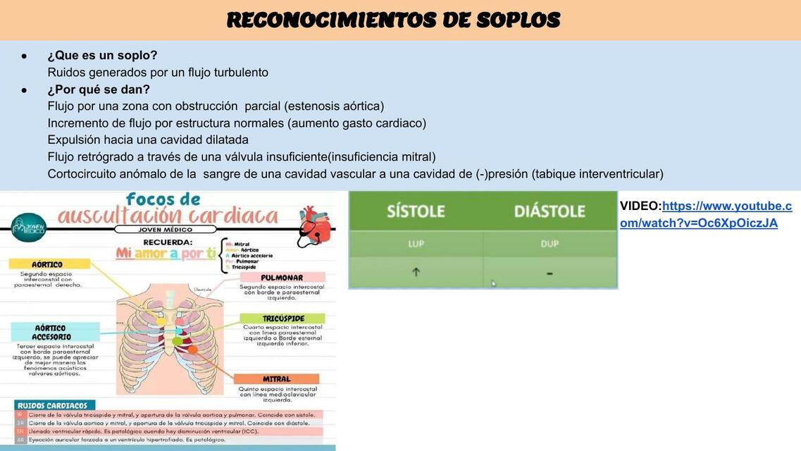 SOPLOS TALLER ECOE UCSUR | Medical student Kath ESGA🩺☀️ | uDocz SOPLOS TALLER ECOE UCSUR | Medical student Kath ESGA🩺☀️ | uDocz