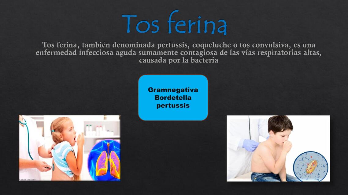 Flashcards de TOS FERINA | Por huber | uDocz