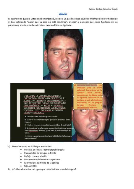 Caso clínico Neurología | Medical student Kath ESGA🩺☀️ | uDocz