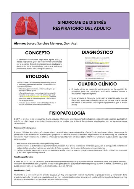 SDRA | 3282828282lsls | uDocz