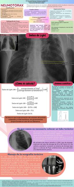 NEUMOTORAX INDICE DE LIGHT | Joselyn Caceres | uDocz