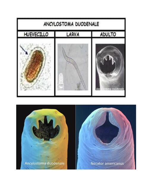 UNCINARIASIS 1 | Edu | uDocz