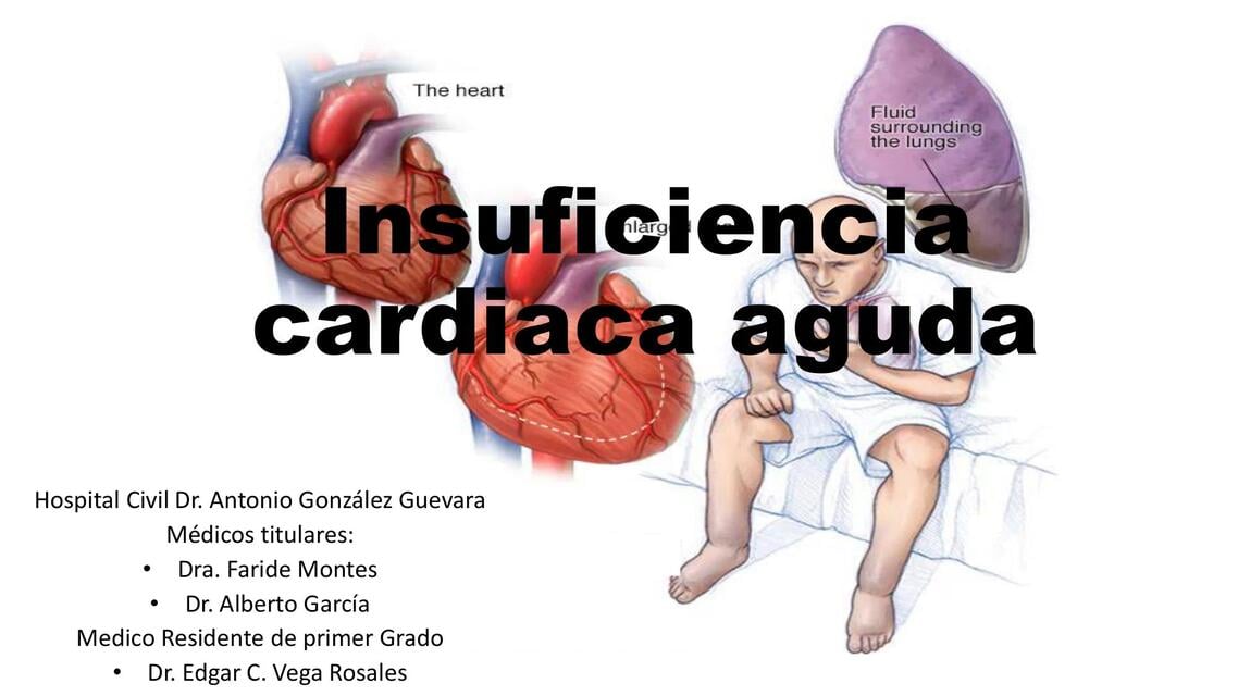 Flashcards de Insuficiencia cardíaca aguda | Por Edgar | uDocz