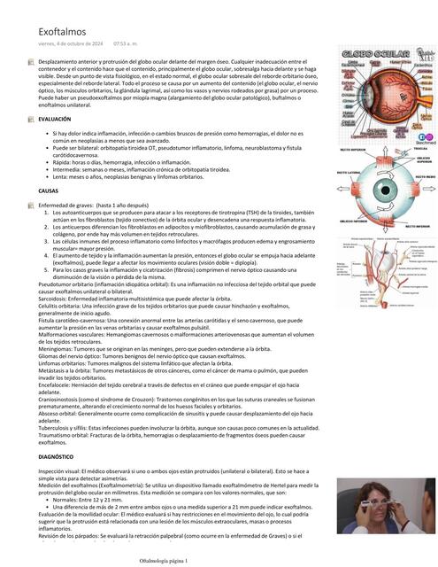 Exoftalmos | Elizabeth Piquet | uDocz