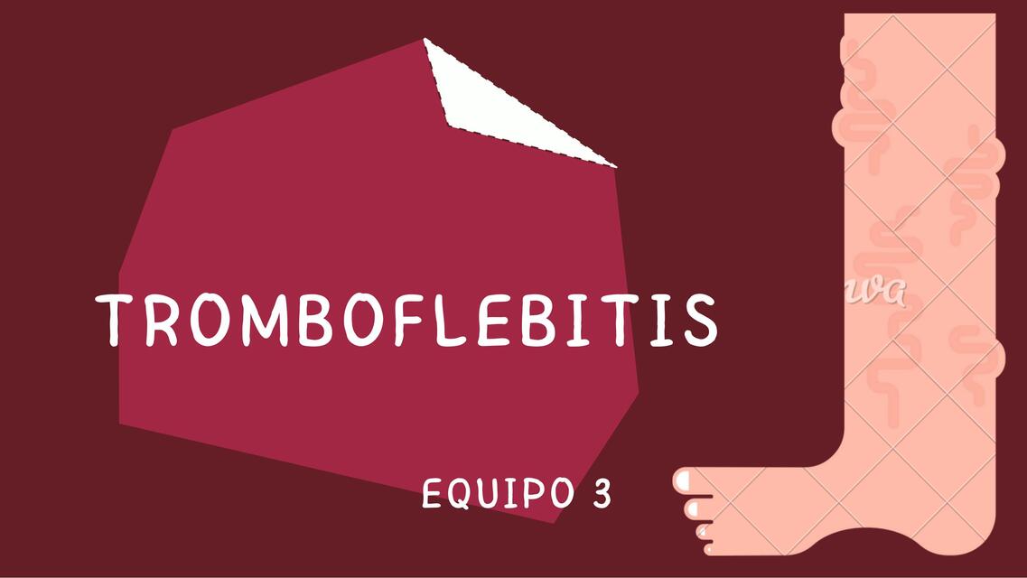 Tromboflebitis | Adrian Uicab | uDocz