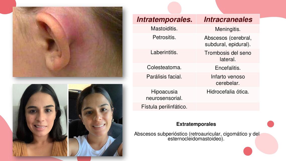 OTITIS MEDIA CRONICA | Monica Patricia | uDocz