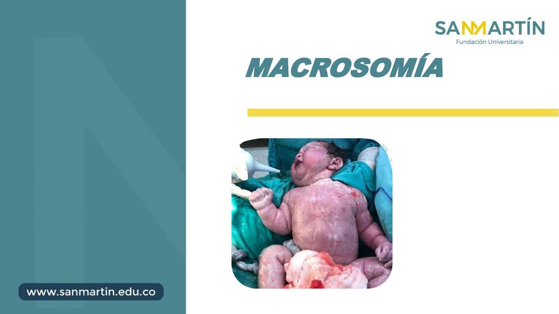 MACROSOMÍA 1 | Andres | uDocz