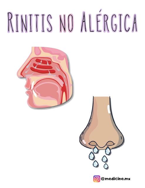 Rinitis No Alergica | Dra. Ligeia Vieytez | uDocz