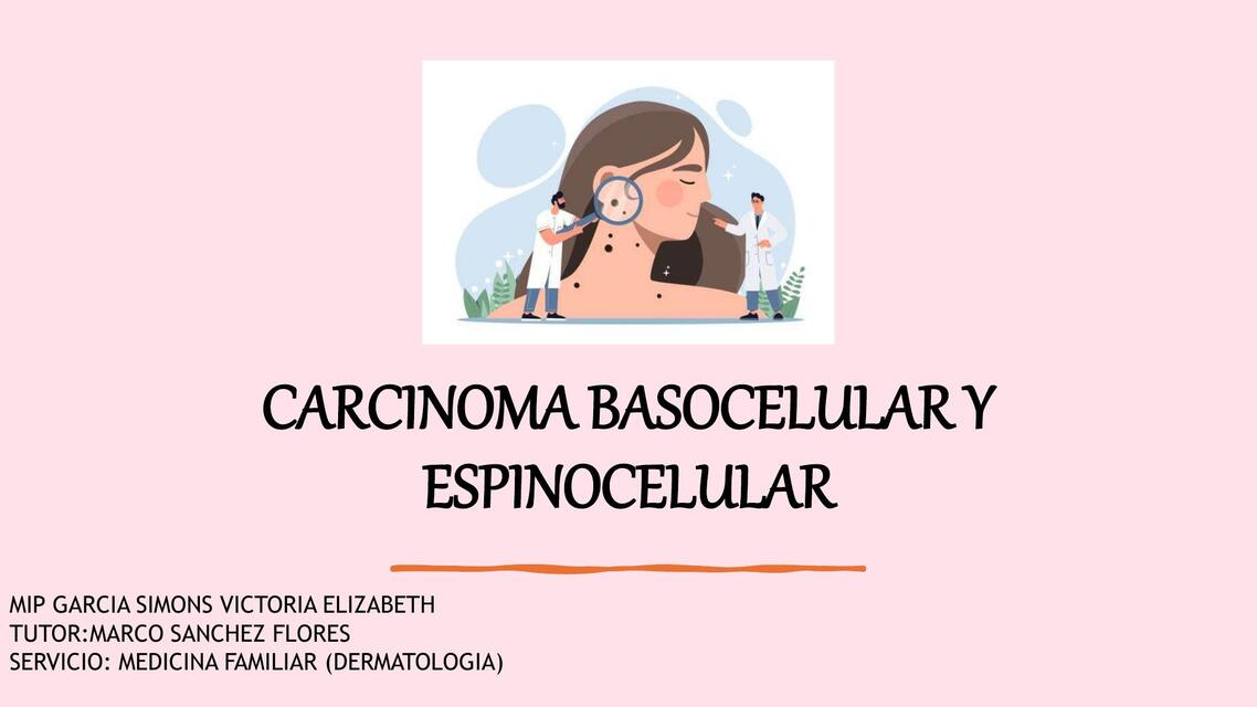 ca basocelular y espinocelular | Victoria Garcia | uDocz