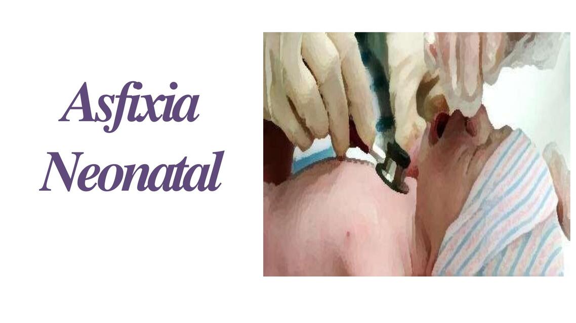 Flashcards de ASFIXIA NEONATAL | Por Daviid Patiño | uDocz