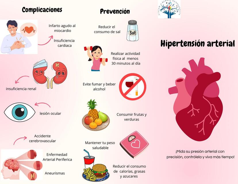 Hipertensión Arterial Consuelo Conejeros Udocz
