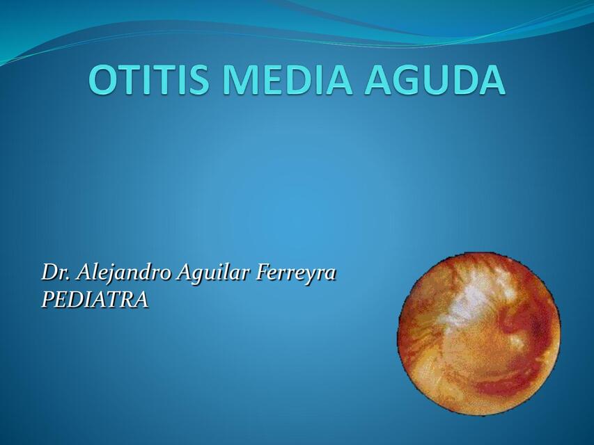 Flashcards de OTITIS MEDIA AGUDA | Por NM | uDocz