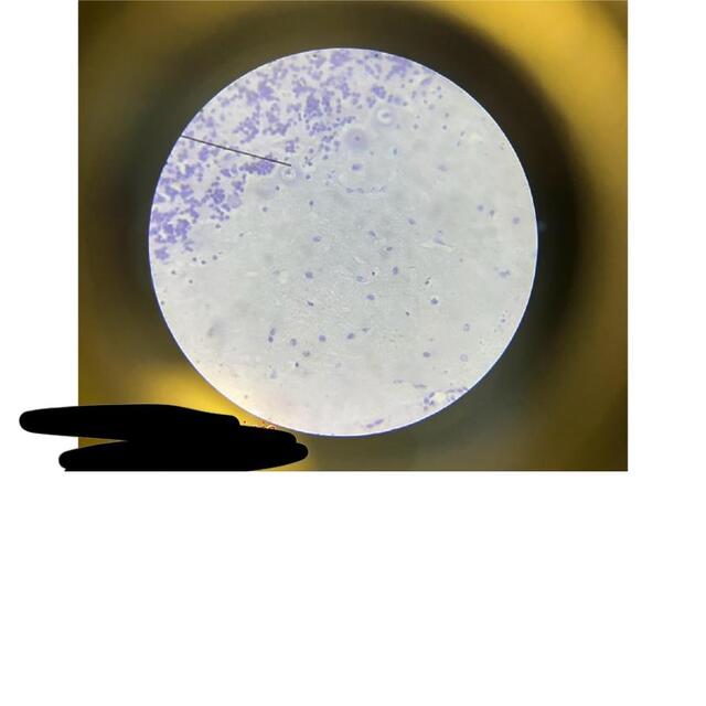 Preparados | BEATRIZ | uDocz