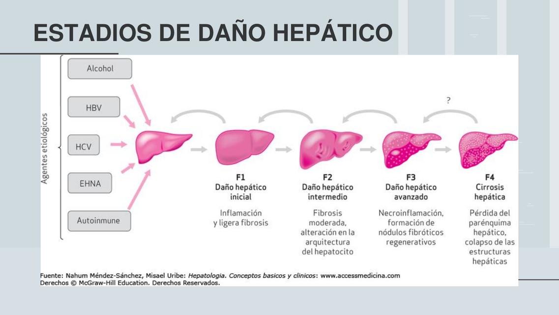 CIRROSIS | RESUMED | uDocz