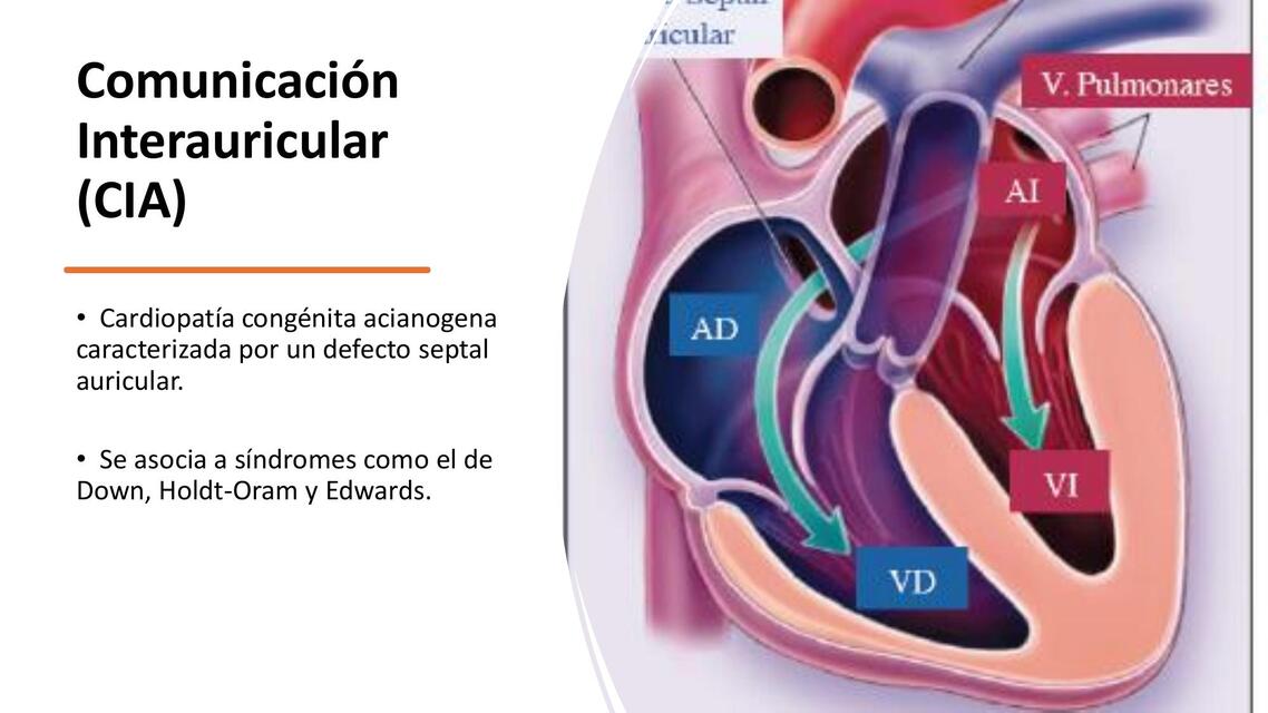 Comunicacion Interauricular CIA | Oswaldo avila cabrera | uDocz