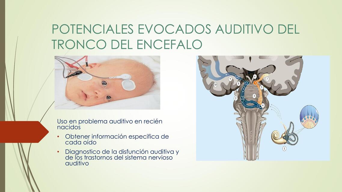 POTENCIALES EVOCADOS AUDITIVO DEL TRONCO DEL ENCEF | nory timaure | uDocz
