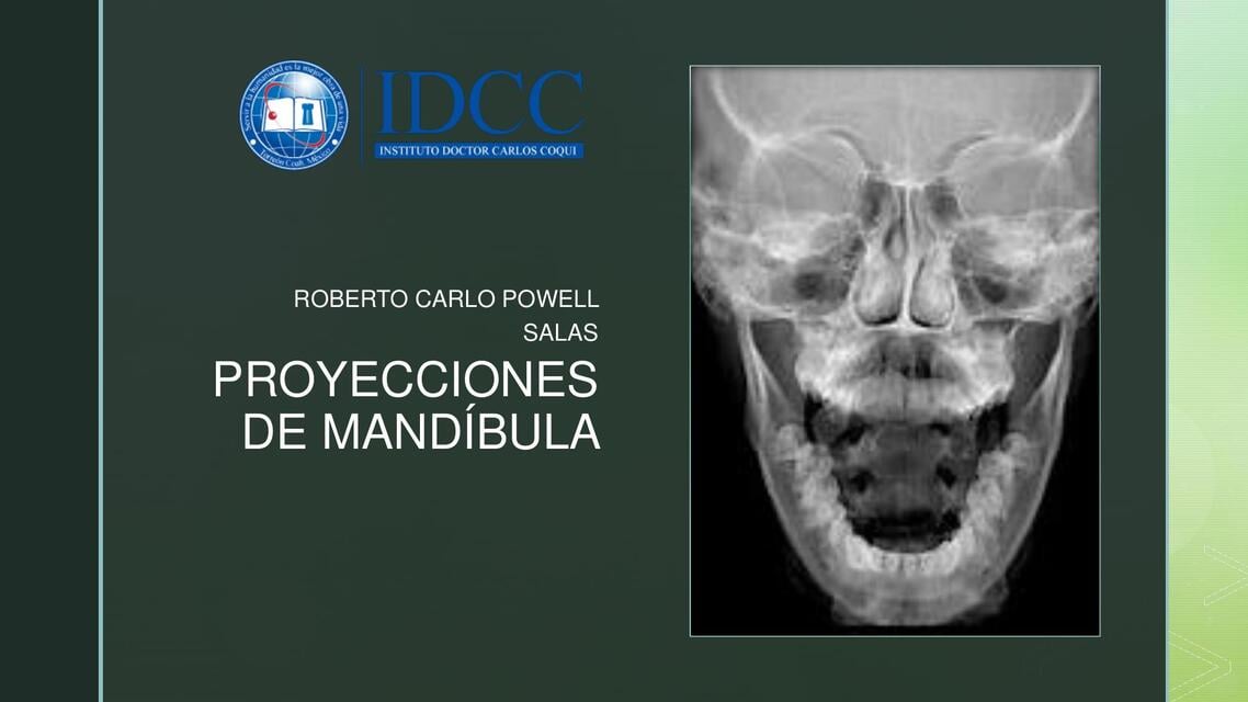 PROYECCIONES DE MANDÍBULA | Roberto Carlo | uDocz
