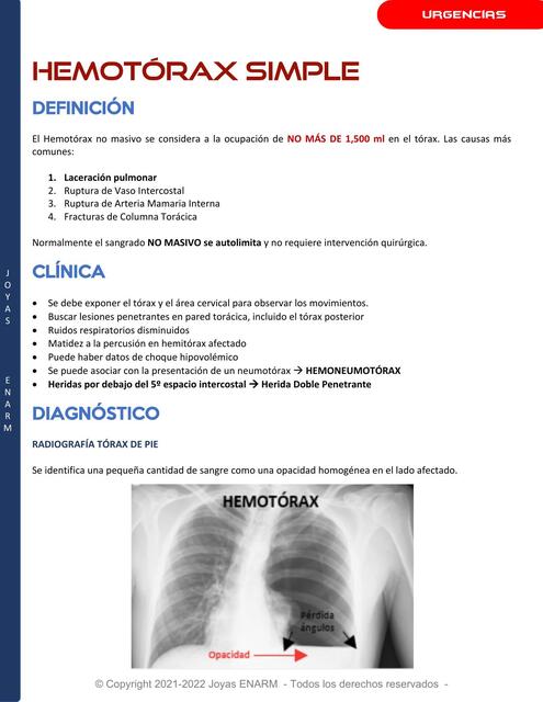 3 Hemotórax Simple y Masivo | Conceptosmedicina | uDocz