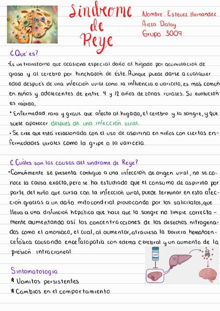 Síndrome de reye | aizza dalay estevez Hernández | uDocz