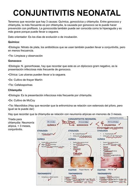 CONJUNTIVITIS NEONATAL | Jhordan | uDocz