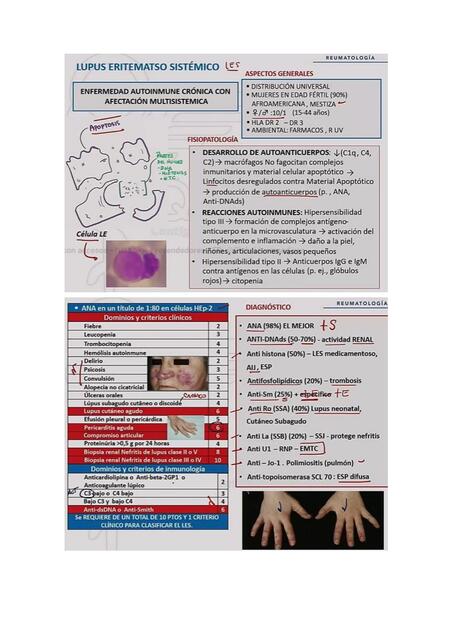 LUPUS 1 | Mariela Marquez | uDocz
