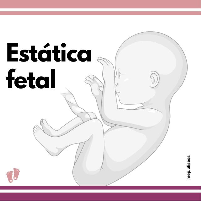 Estática fetal Obstetricia | Ulises | uDocz