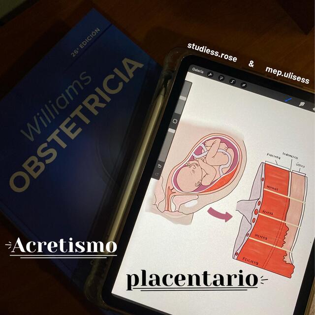 Acretismo placentario- Ginecología y Obstericia | Ulises | uDocz