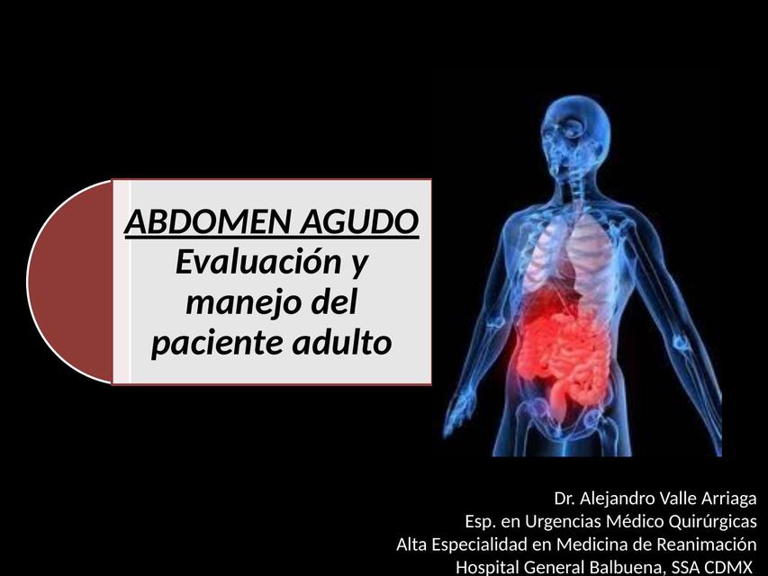 abdomen agudo | G | uDocz