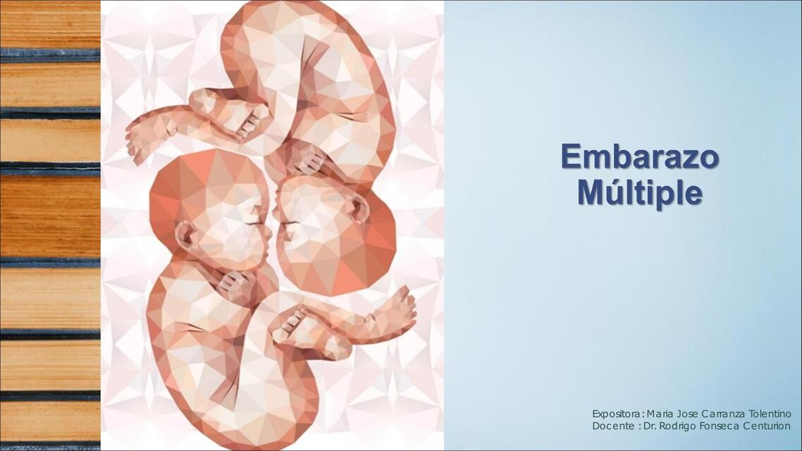 GESTACION MULTIPLE | maria jose | uDocz