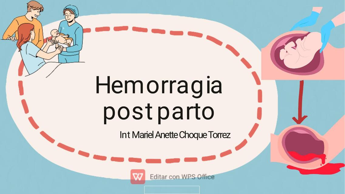 HEMORRAGIA POSTPARTO | Anette Torrez | uDocz